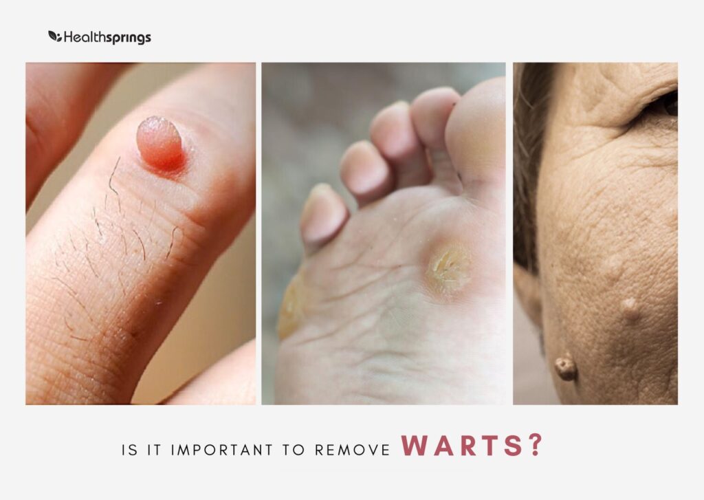 7 Types of Common Skin Bumps (Causes & Treatments)