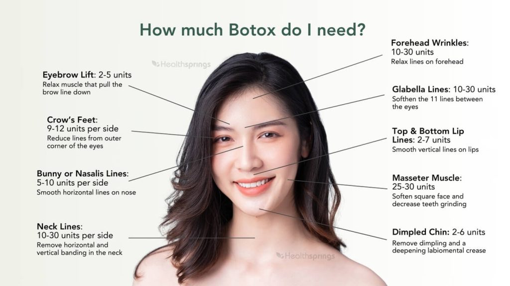 Botulinum Toxin Treatment Singapore | Healthsprings